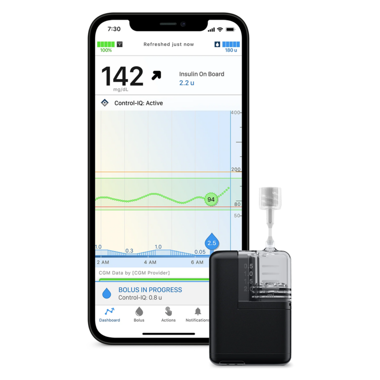 Tandem Mobi System | MyEHCS